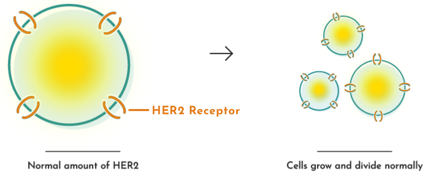 What is HER2-positive Breast Cancer? | PHESGO® (pertuzumab ...